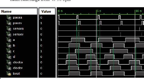 figure 1 from implementation of low delay dual chamber pacemaker using verilog semantic scholar