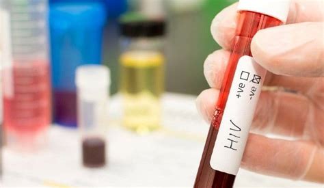 Wirus Hpv Objawy Badania I Leczenie Brodawczaka Ludzkiego