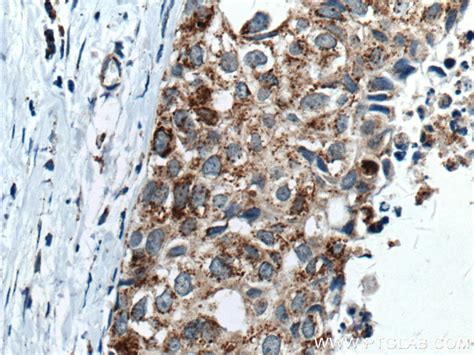 Timp1 Antibody 10753 1 Ap Proteintech