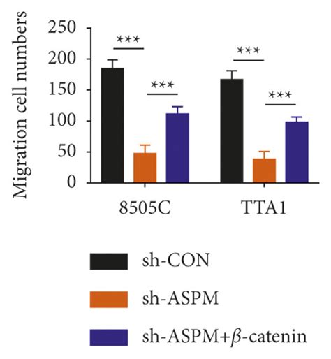 Aspm Regulates The Wnt β Catenin Signaling Pathway In Atc Cells A