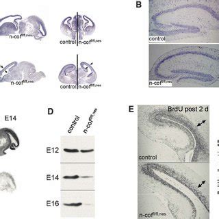 Cell Cycle Block And Impaired Interkinetic Nuclear Migration In The VZ Download Scientific