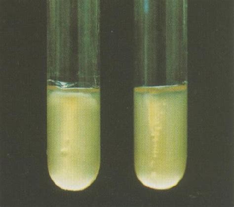 固体半固体培养基液体培养基 个人生物教学资源网
