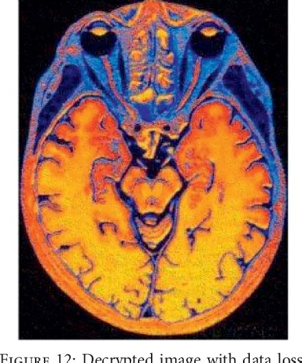 Figure 12 From A New V Net Convolutional Neural Network Based On Four