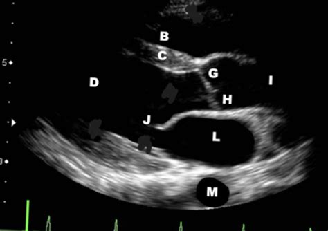 ECHO SCAN MIDTERM VIEWS Flashcards Quizlet ECHO SCAN MIDTERM VIEWS Flashcards Quizlet