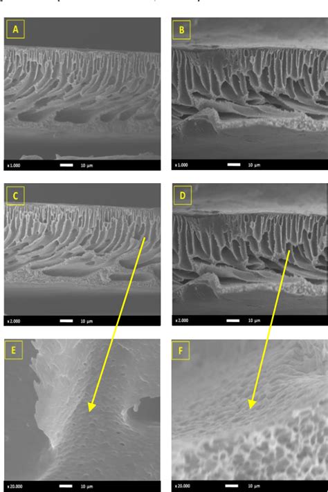 Figure 2 From The Improvement Of Hydrophilic Property Of