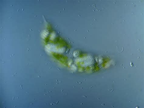 Euglena With Many Paramylon Bodies Images Added