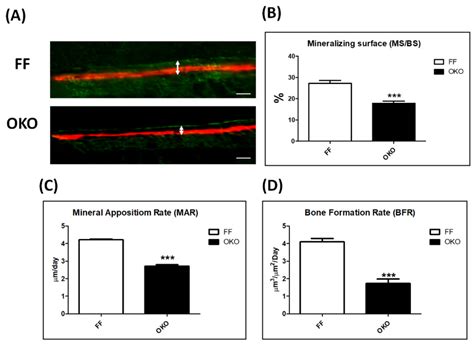 Decreased Bone Formation Rate In The Femurs Of Ddr1 Knockout Mice A