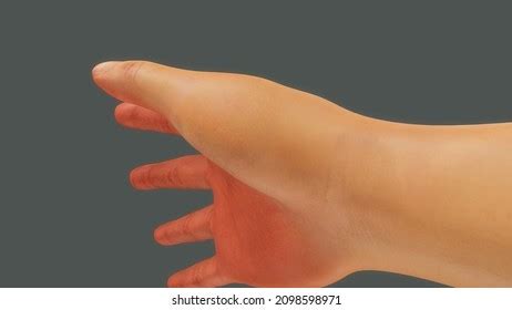 Shaking Tremor Human Hands 3d Illustration Stock Illustration
