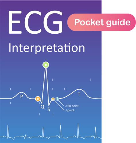 Early Repolarization Pattern On Ecg Early Repolarization Syndrome