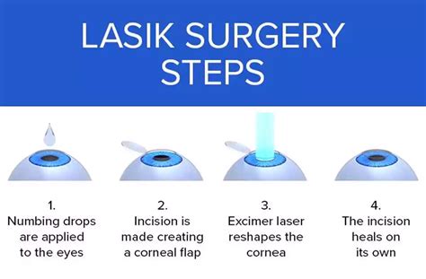 Who Invented Laser Eye Surgery