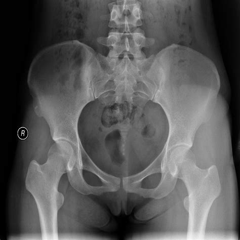 Unnamed Object Detection Dataset And Pre Trained Model By Hust