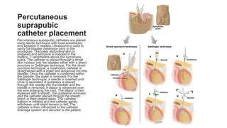 Urinary Bladder Catheters Aaron Pptx