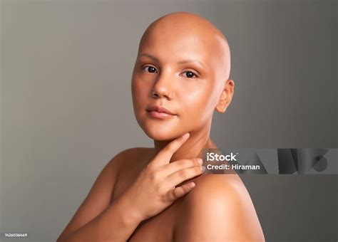 Woman Bald Portrait And Pose With Studio Background For Hair Loss