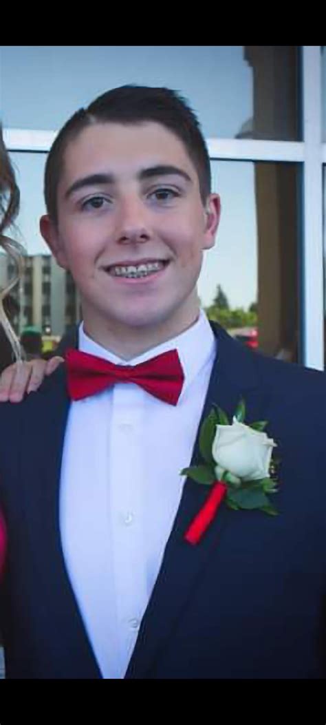 What Wrong With My Face R Mewing