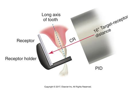 Paralleling Technique Diagram Quizlet