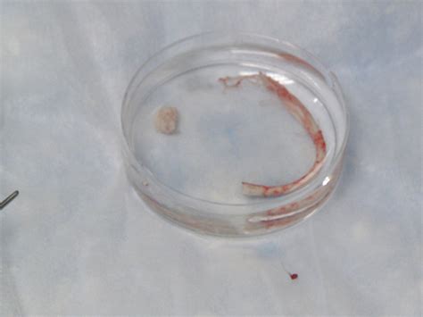 Video Isolation Of Neural Stem Progenitor Cells From The Periventricular Region Of The Adult