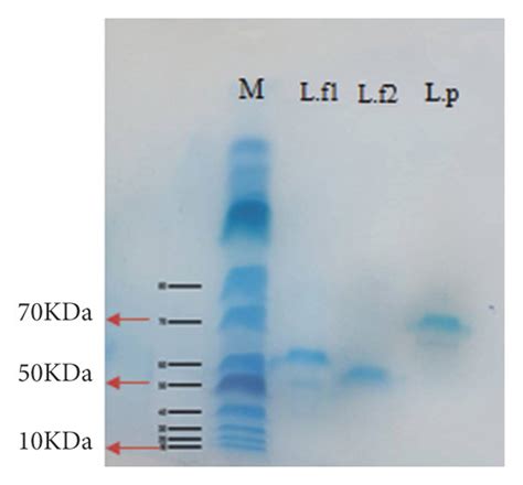 Bacteriocins Isolated From Two Strains Of Lactobacillus Fermentum Lf1 Download Scientific