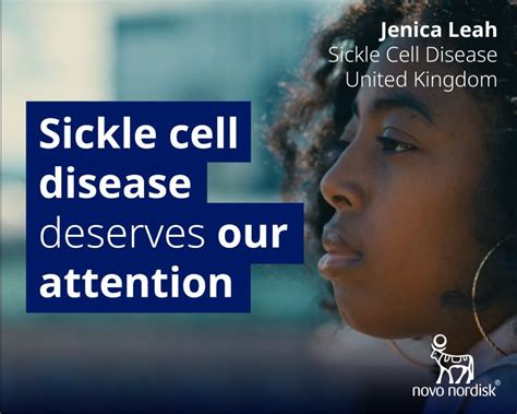 Ify Osunkwo Md Mph On Linkedin Scd Juneteenth Burdenofscd Liveunlimited