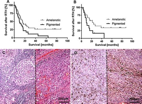 Melanin Content In Melanoma Metastases Affects The Outcome Of