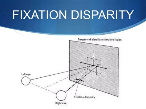 Binocular Single Vision Pptx