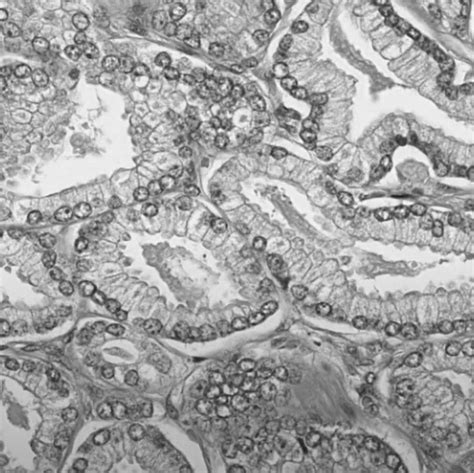 V社区 机器智能技术交流 自定义算子实现灰度图像的像素点灰度值整体增加操作