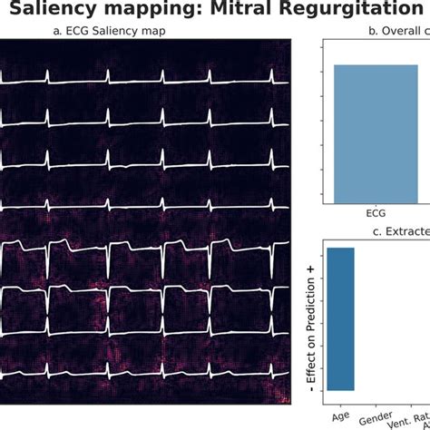 Model Interpretability Aortic Stenosis Panel A Input Pixels Most Download Scientific Diagram