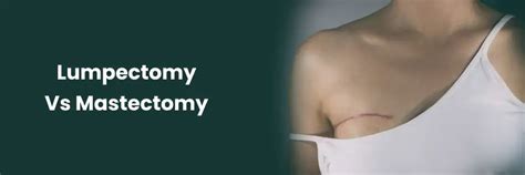 Lumpectomy Vs Mastectomy Procedure Comparison
