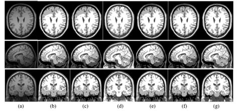 The Segmentation Results For Mr Images With Intensity Inhomogeneity Download Scientific