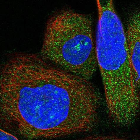 Rabbit Polyclonal Anti Abtb1 Antibody Buy For Research Highly Specific Rigorously Validated