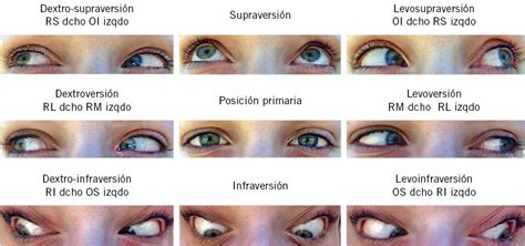 Oftalmología Pediatría Integral