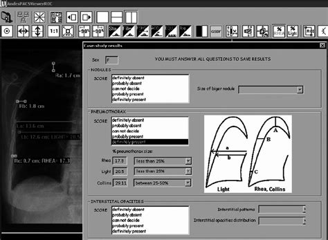Software Tools For The Quantification Of Pneumothorax Size Download Scientific Diagram