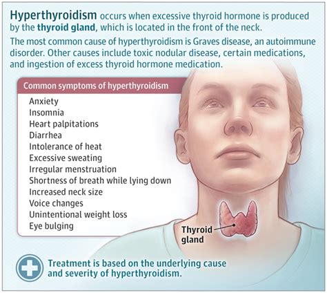 What Is Hyperthyroidism A Jama Patient Page Thyroid Uk