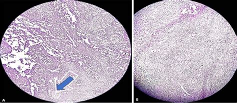 Pictures Of The Histopathology Specimen Slides A Low Power View