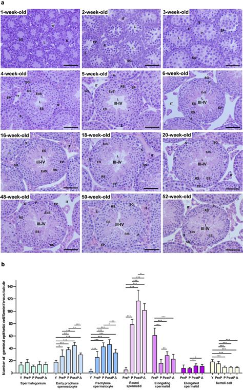 A Representative Micrographs Of The Postnatal Mouse Testes From 1 To