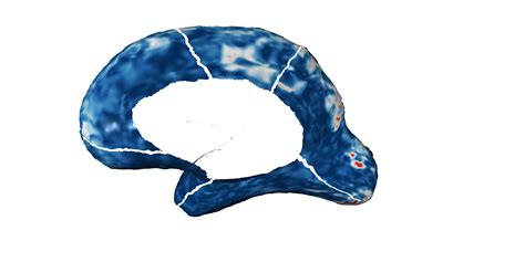 The Brain Is Not Properly Flattened · Issue 419 · Gallantlabpycortex · Github