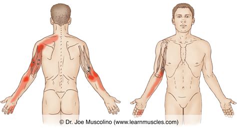 Triceps Brachii Trigger Points Learn Muscles