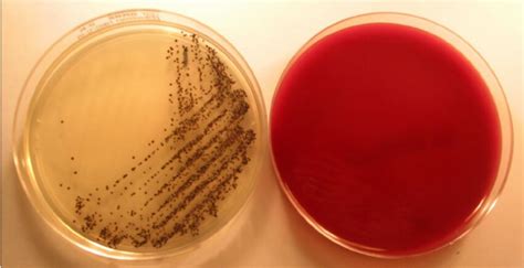 Chromid® C Difficile Agar Scheda Del Terreno Di Coltura Microbiologico