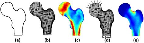 Process Of Constructing Dxa Based Finite Element Model A Contour Of Download Scientific