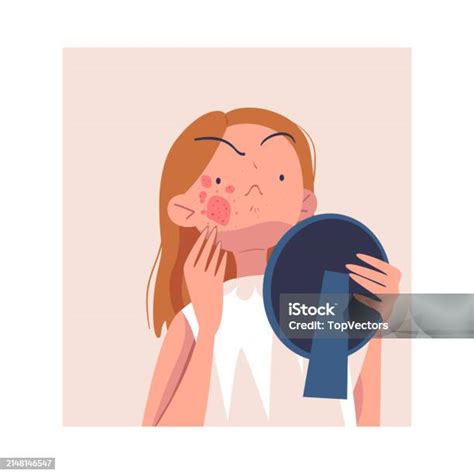 여자 특성 와 피부 문제 고통 와 가려움증 얼굴 거울 벡터 일러스트 거울에 대한 스톡 벡터 아트 및 기타 이미지 거울 건강관리와 의술 건선 Istock