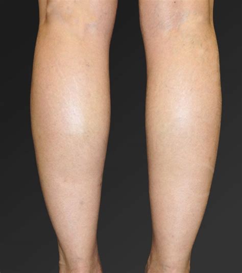 How To Tone Calves And Ankles
