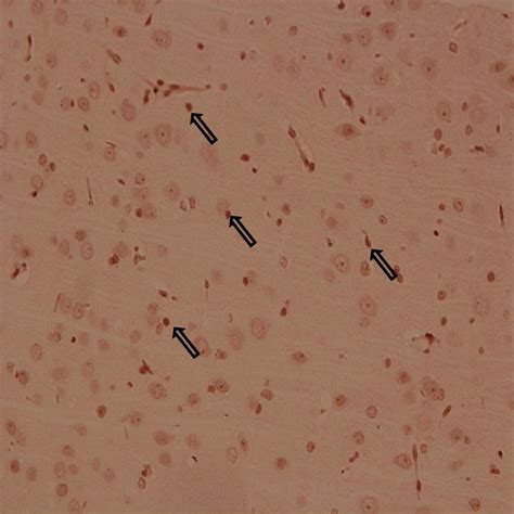 Could Anybody Help Me Interpret My With Methyl Green Staining Researchgate