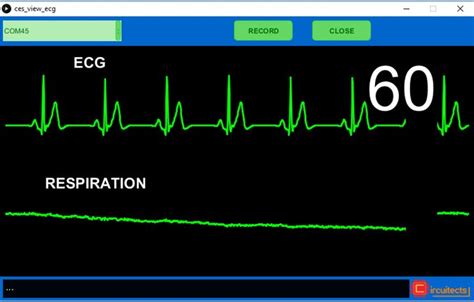Monitor Ecg And Respiration Using Your Arduino Arduino Project Hub