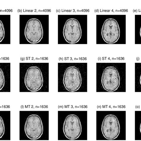 Reconstruction Of Mri Images With Hybrid Cs A E Linear Download