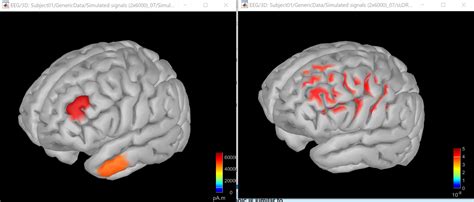 Behaviour Of Sloreta With Simulation In Brainstorm Discussions