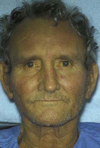 Biochemical Tests Quiz 3 Flashcards Quizlet