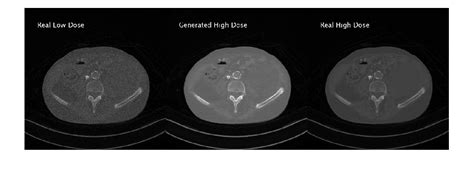 Unsupervised Medical Image Denoising Using Cyclegan Matlab And Simulink