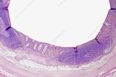 Cross Section Of The Human Appendix Stock Image C Science Photo Library