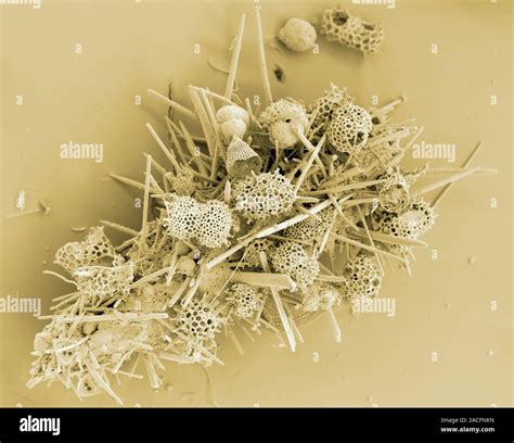 Marine Protozoa Shells Coloured Scanning Electron Micrograph Sem The Shells Tests Seen