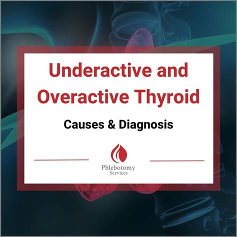 Underactive And Overactive Thyroid A Guide Phlebotomy Services Ltd Posted On The Topic Linkedin