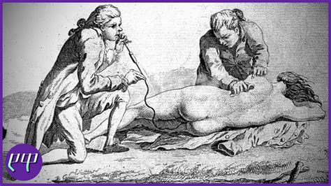 მკურნალობის ყველაზე უცნაური მეთოდები ★ ტოპ ფაქტები ★ Youtube